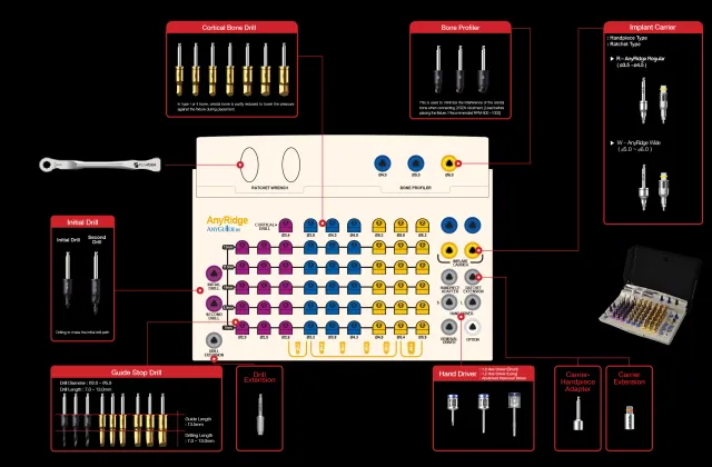 Guided Kit for The AnyRidge Implant